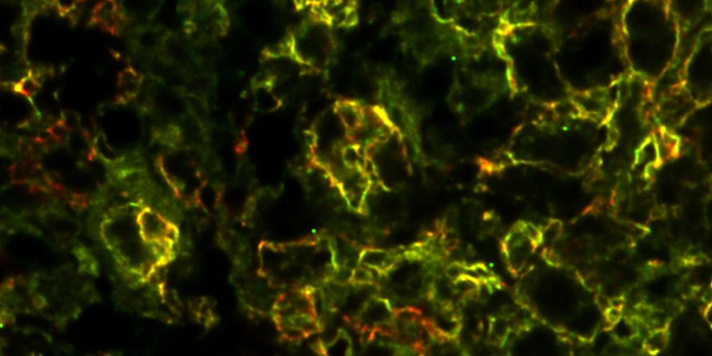 See our tech talk at Cell Bio, Monday @ 1:15, Rm 150