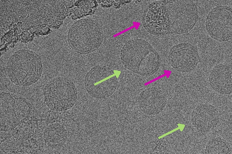 Direct Imaging of Payload Distribution of DNA and RNA in Lipid ...