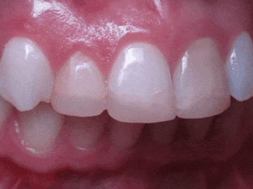 Premier Dentistry In The Woodlands, TX | Woodlands Family Dental