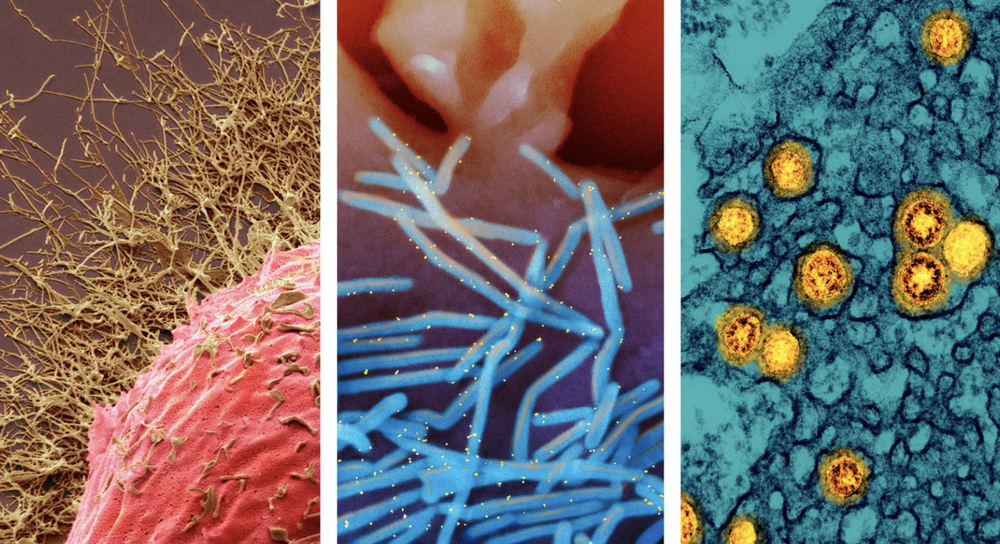 The Tripledemic: Why Viruses Are Hitting Harder This Year and What Can ...