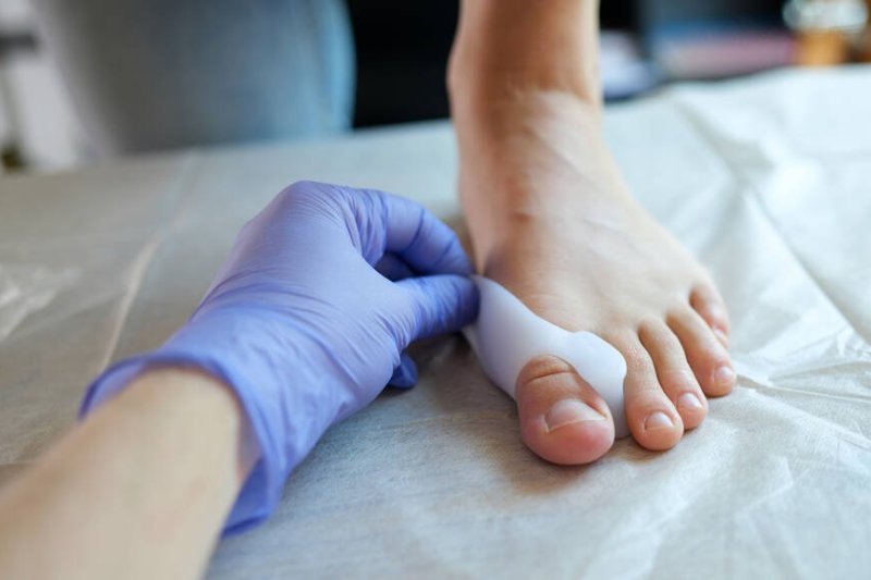 What Exactly Is A Bunion? | Orthotic Solutions Podiatry