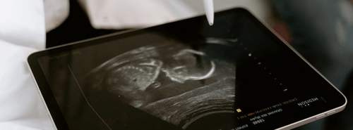 La primera radiografía y lo que significa para el mundo - Eva