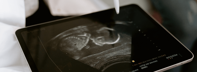 La primera radiografía y lo que significa para el mundo - Eva