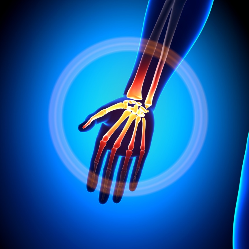 Wrist & Hand - Stretching, Exercises, & Posture | Work-Fit