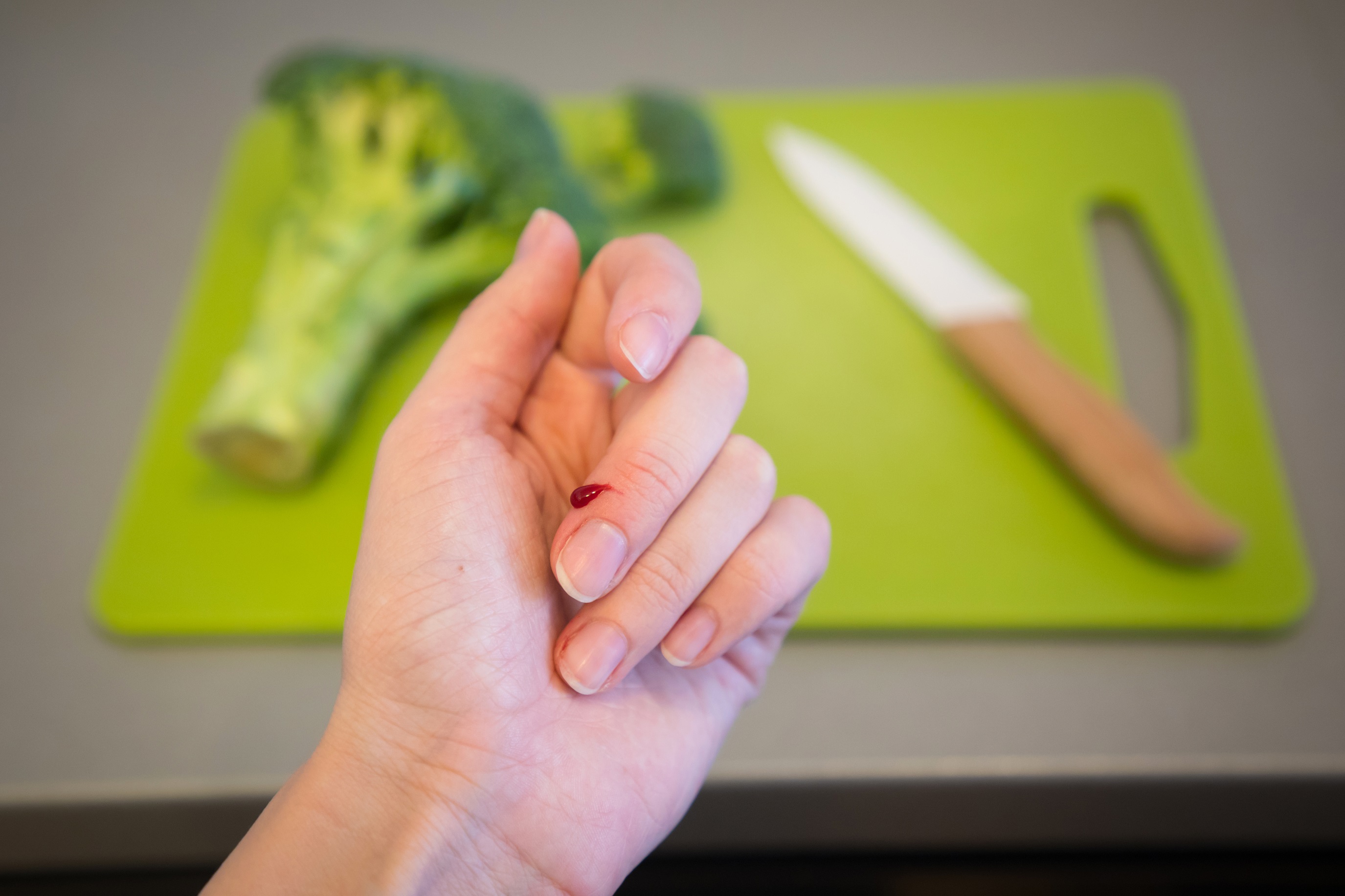 Preventing Injuries in the Food Preparation Industry | Work-Fit Blog