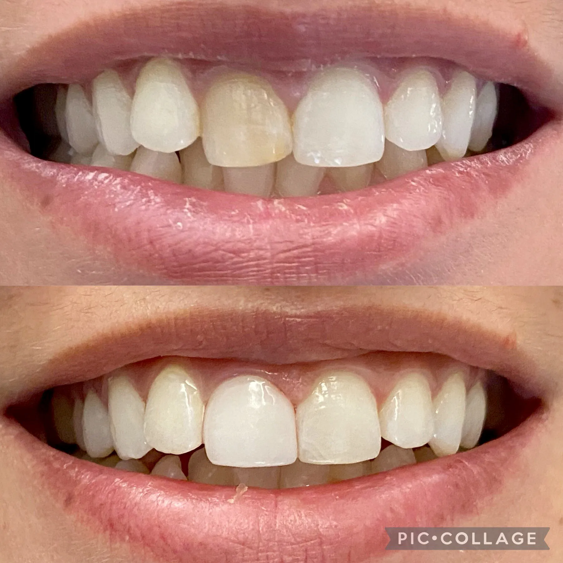 Smile Gallery | Damascus Dental Center | Before and After ...