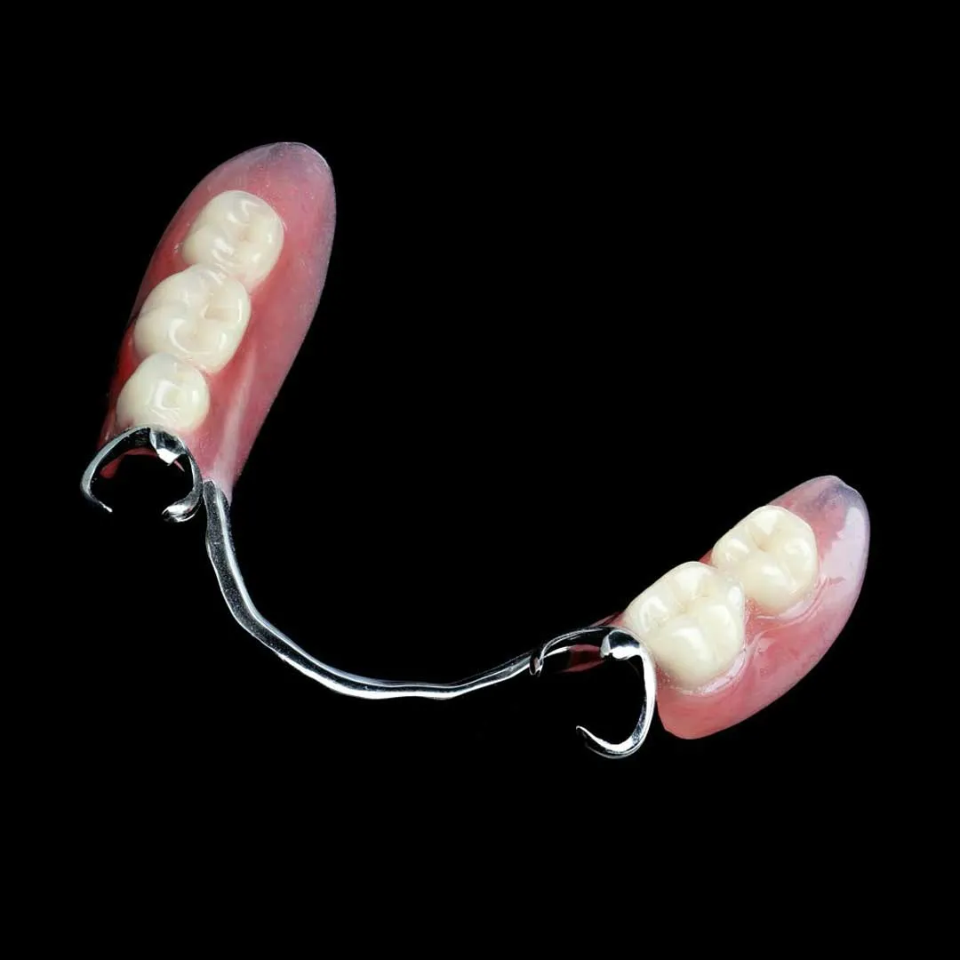 Metal partial vs flexible partial denture choices. | New Smile Dentures