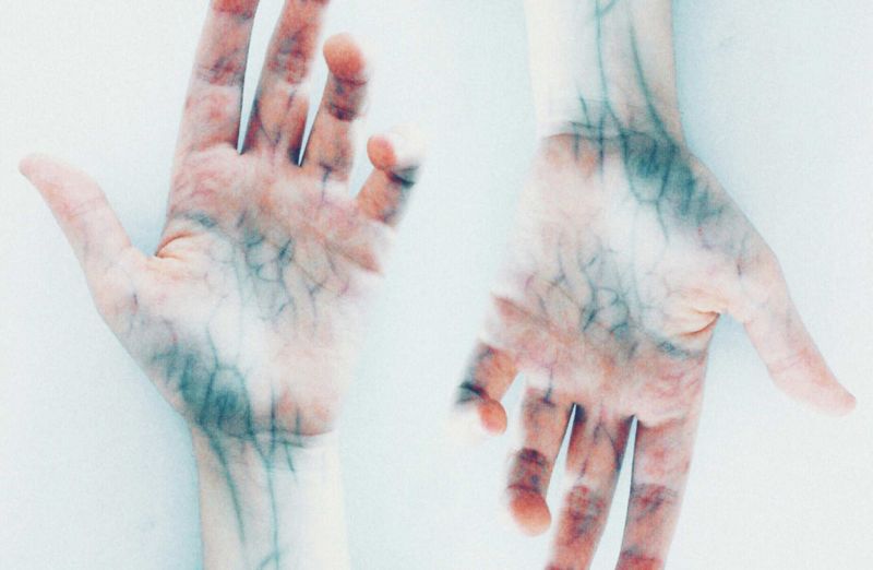 Blog Afya Educação Médica - Vasculite: entenda como ocorre a inflamação ...