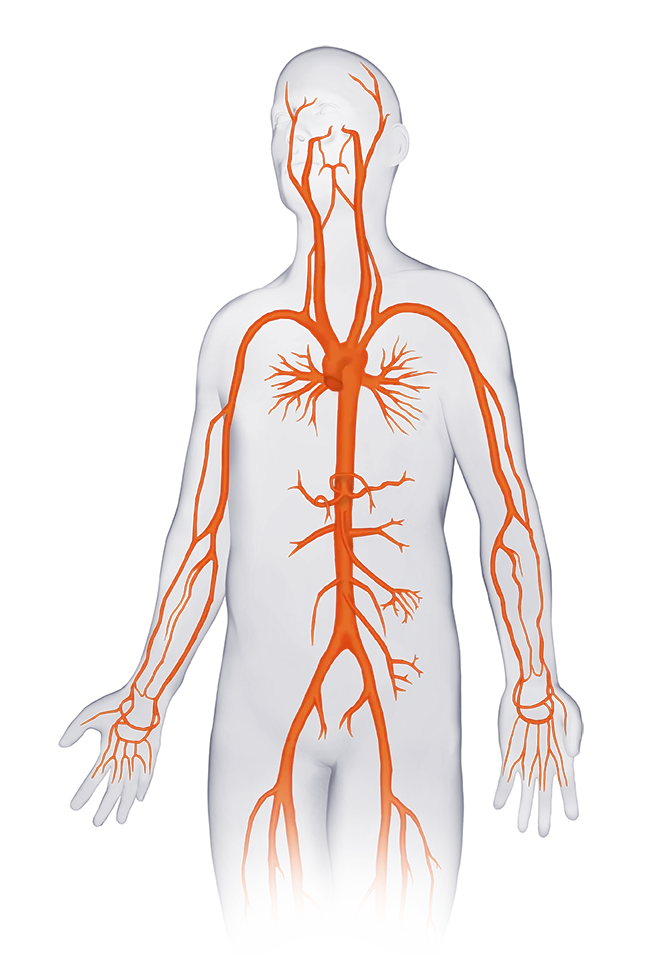 Medistim: Pioneers of TTFM Transit Time Flow Measurement Technology