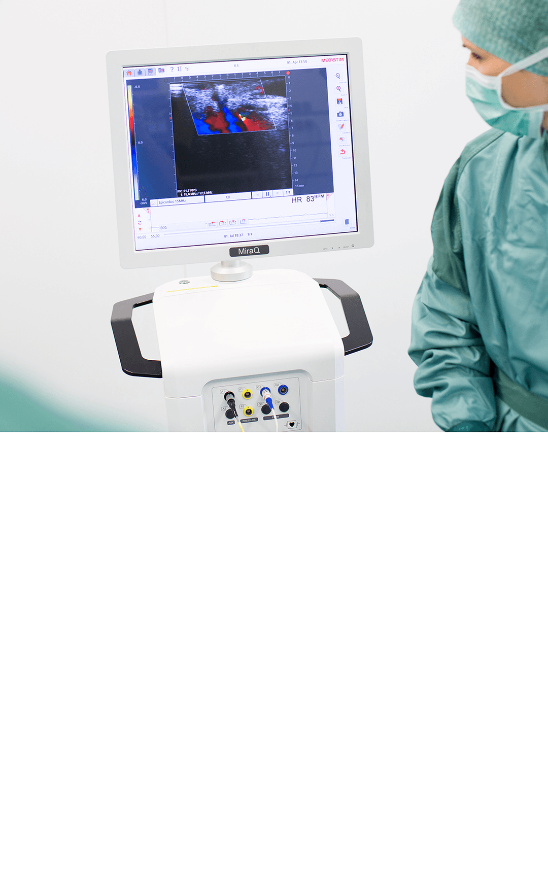 MiraQ Ultimate: Intraoperative System for Cardiac Vascular Transplant