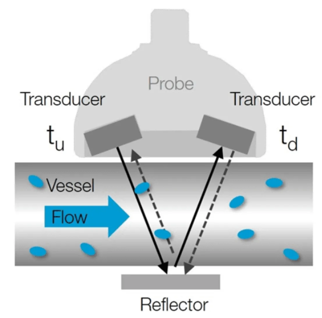 Medistim TTFM Probes: Enhancing Flow Measurement in Surgery