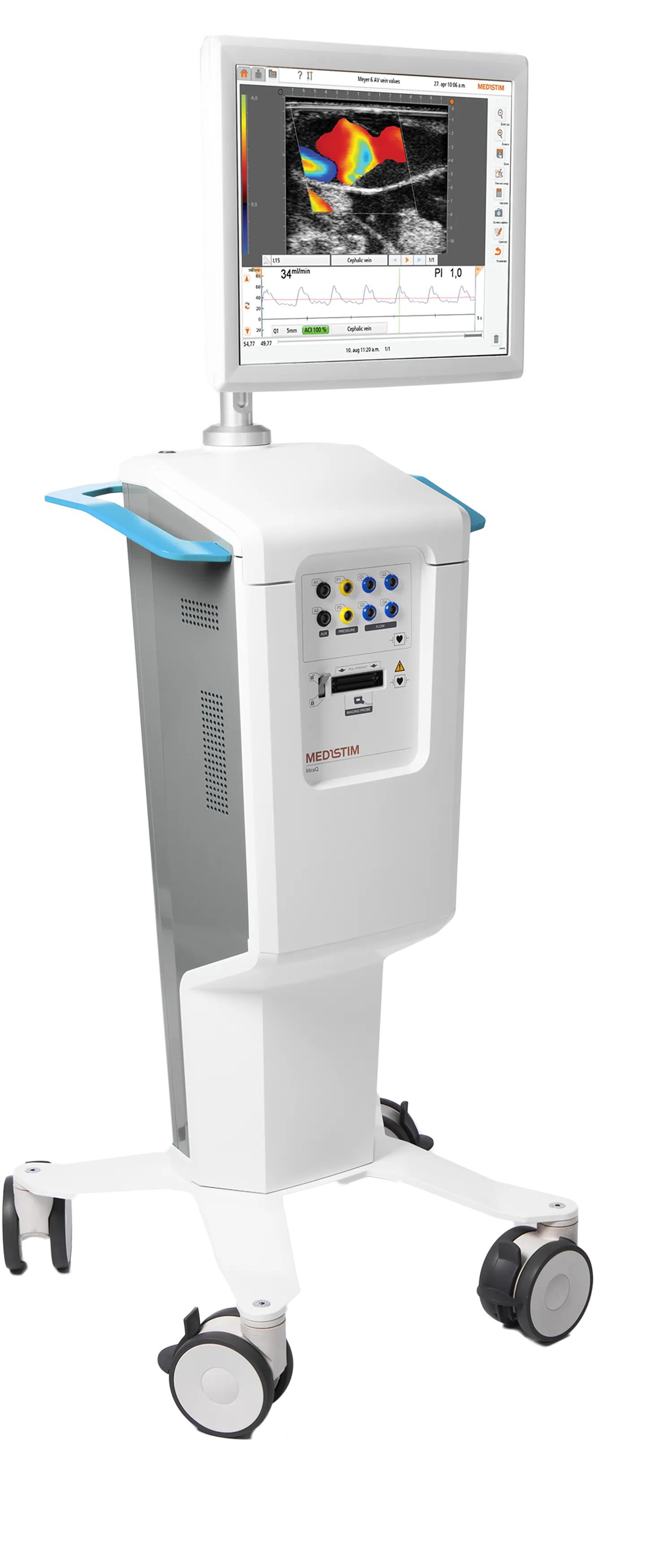 MiraQ™ Vascular: Advanced Vascular Surgery Technology | Medistim