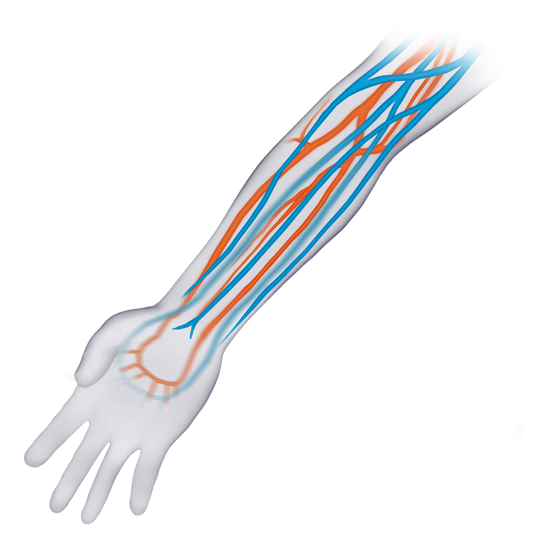 MiraQ™ Vascular: Advanced Vascular Surgery Technology | Medistim