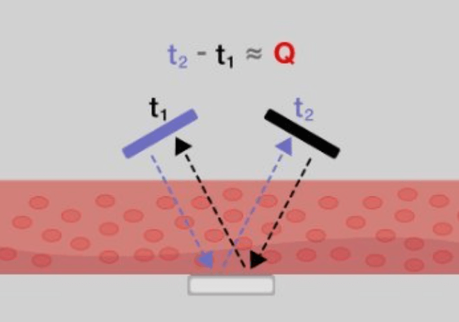 MiraQ™ Cardiac: Precision Cardiac Surgery System | Medistim