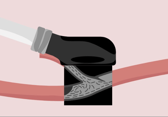 MiraQ™ Cardiac: Precision Cardiac Surgery System | Medistim