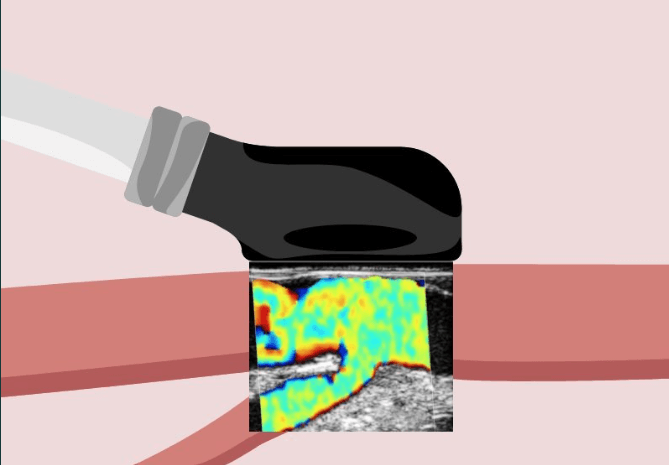 MiraQ™ Cardiac: Precision Cardiac Surgery System | Medistim