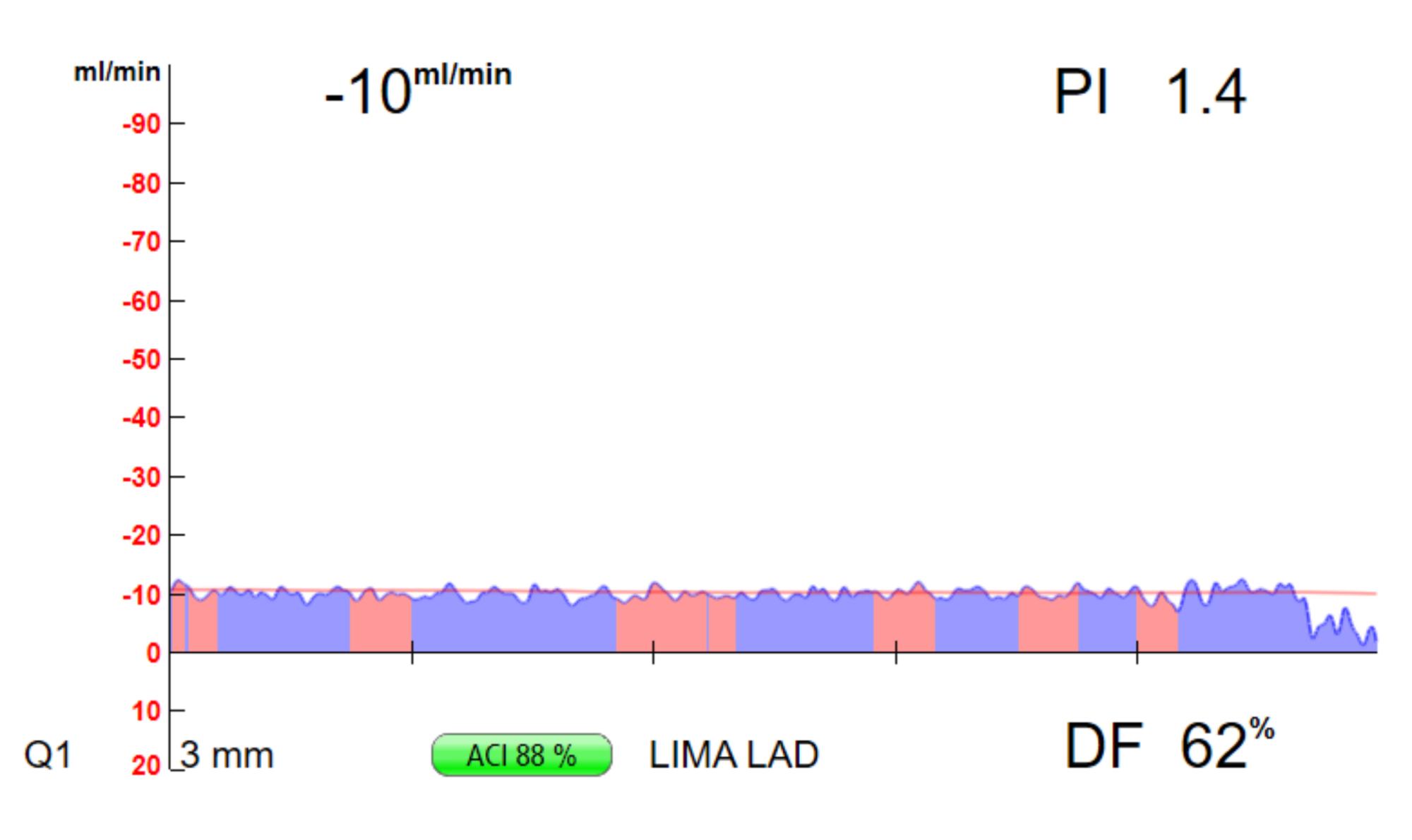Valuable Insights: Trusting Your Flow Numbers in CABG Procedures