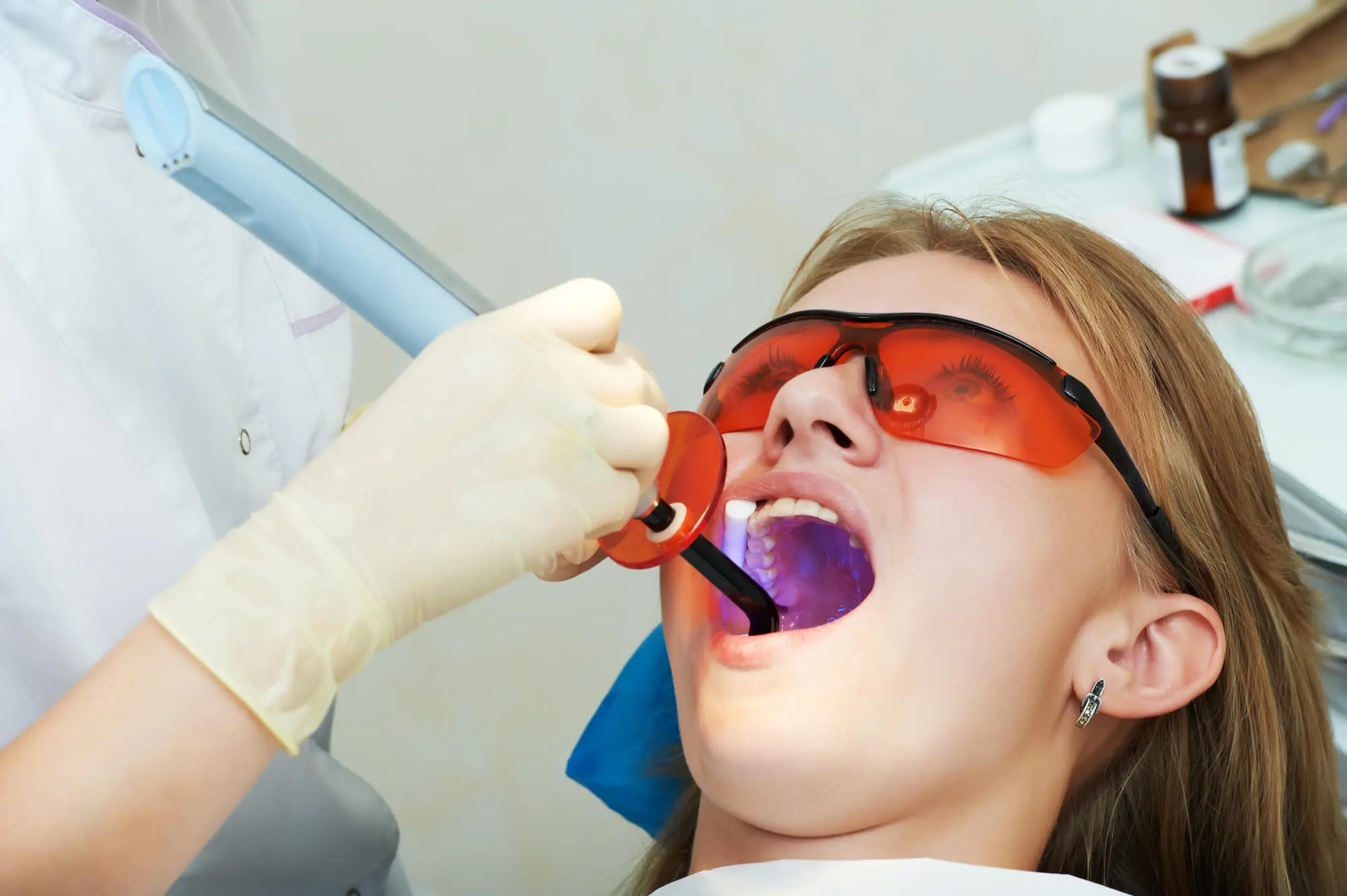 Sealants | Dental Wellness of Bartow