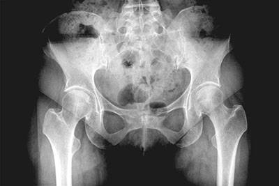 Radiobotics — We Augment Radiology through AI & Machine Learning