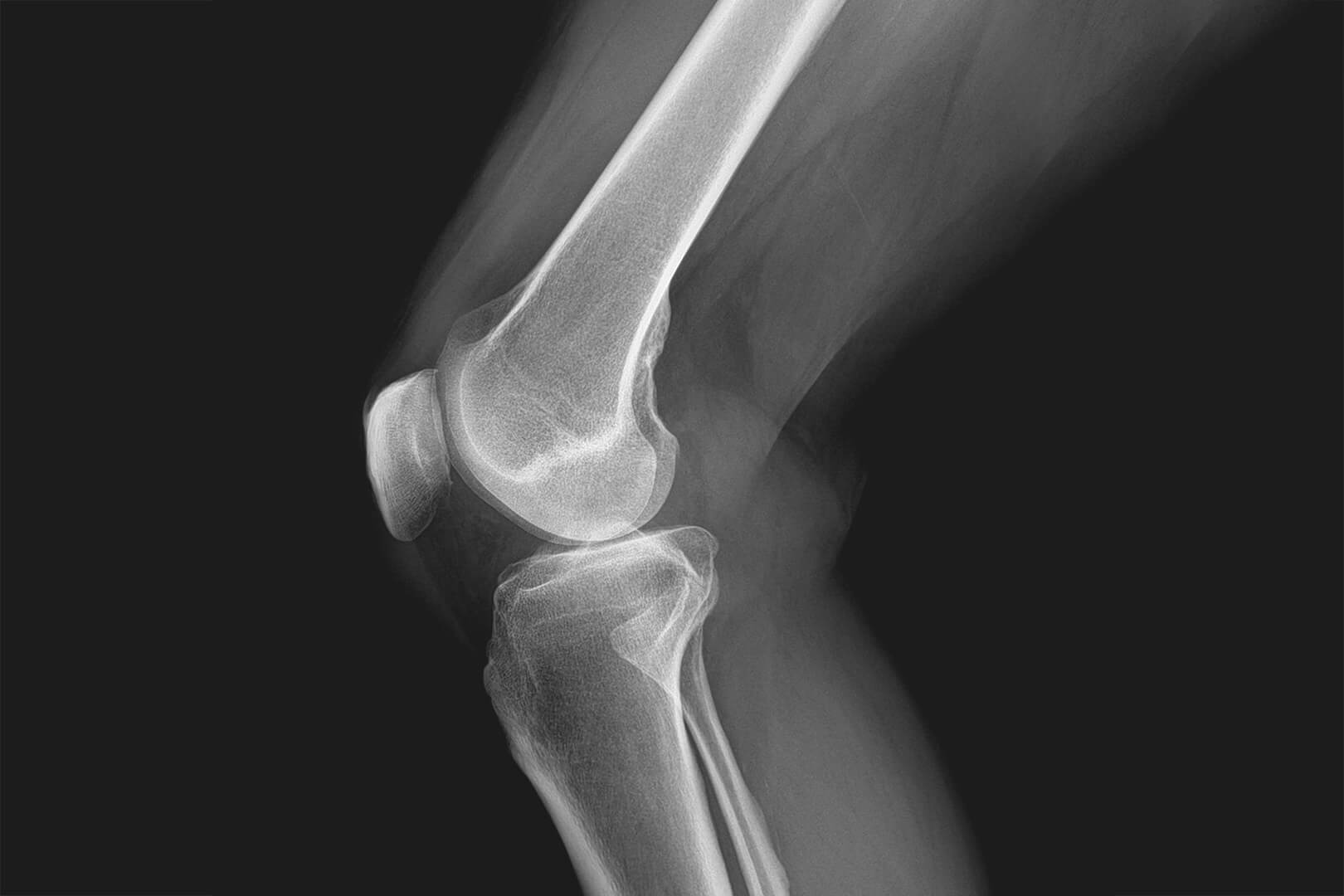 Radiobotics — We Augment Radiology through AI & Machine Learning