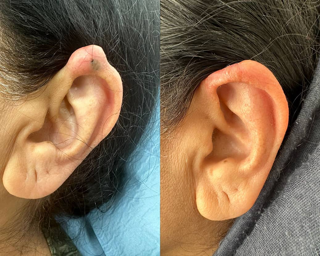 Mole Removal Birmingham | Mole Removal Solihull – AL