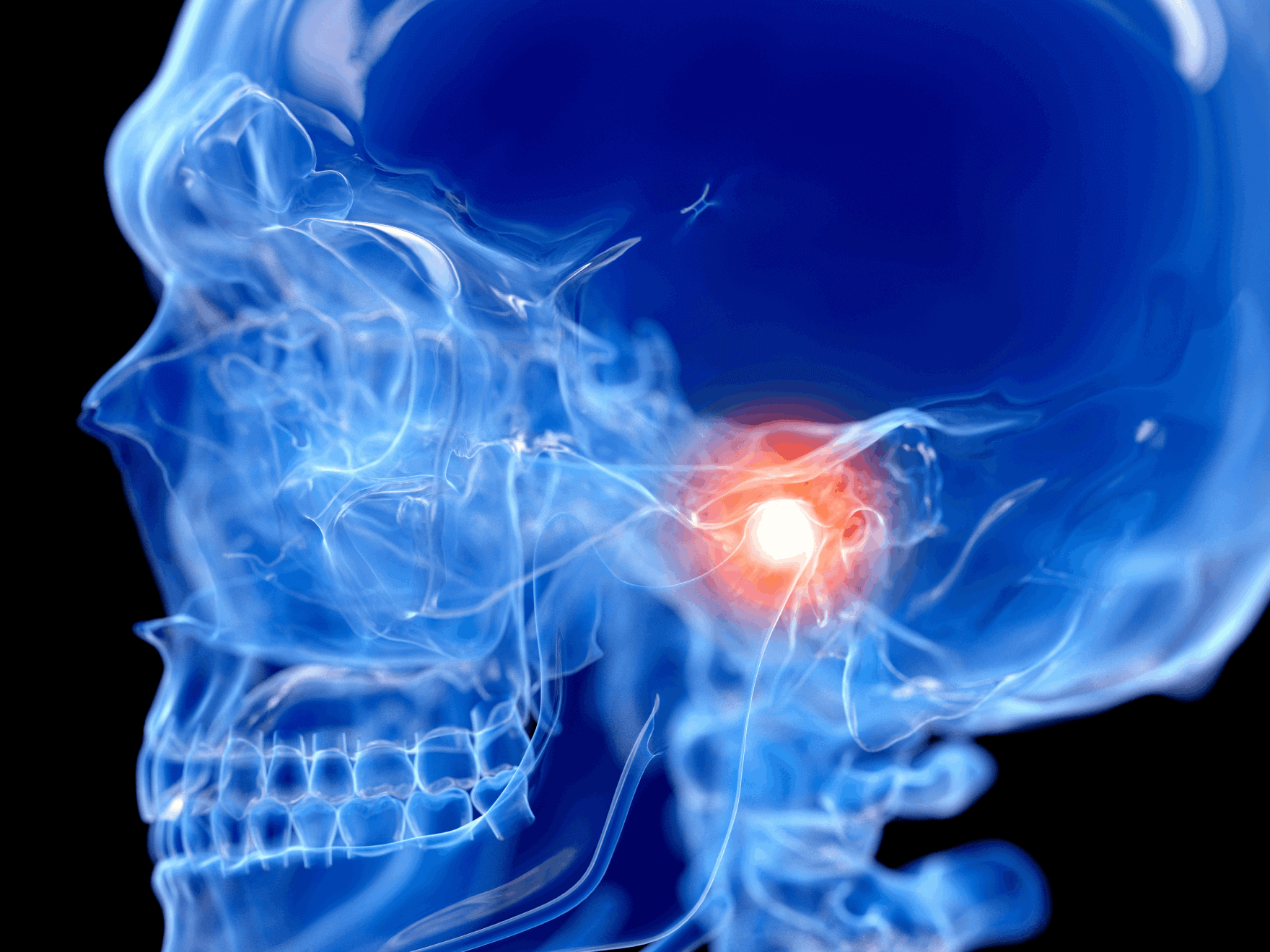 TMJ Injections for Pain Relief | Elkridge, MD