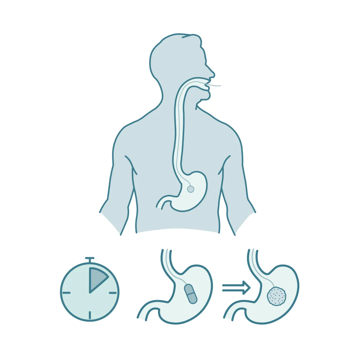 EndoSign® | Patients - What to expect