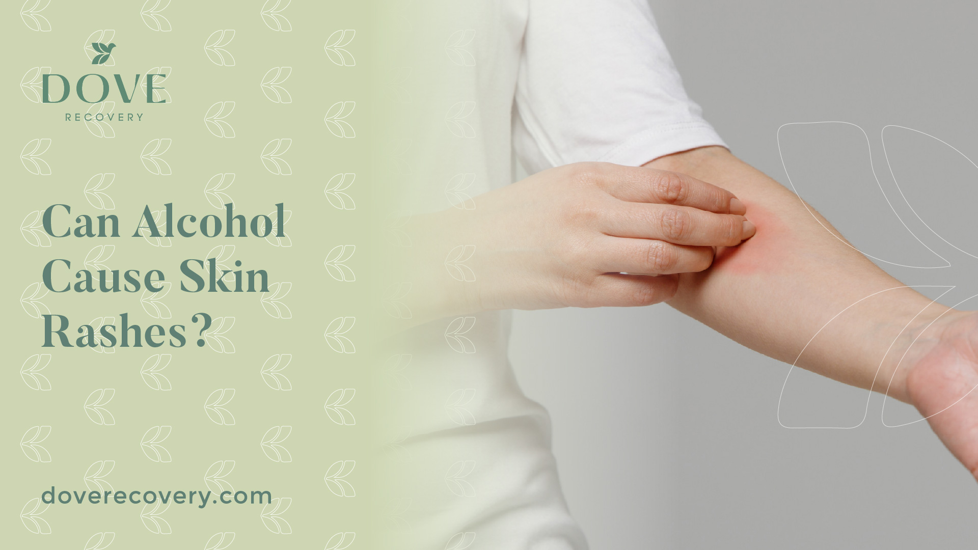 Can Alcohol Cause Skin Rashes?