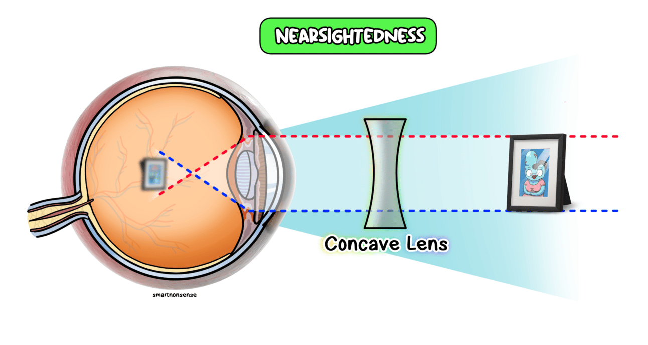 How Do Glasses Help Us See? 👓