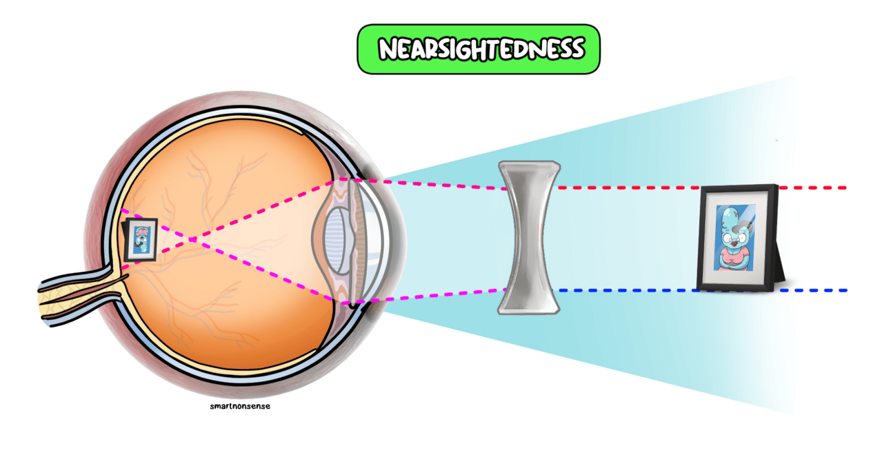 How Do Glasses Help Us See? 👓