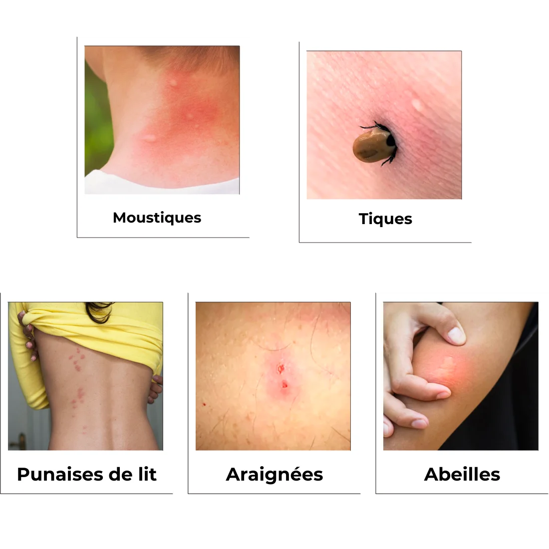 Comment reconnaitre une piqûre de punaise de lit