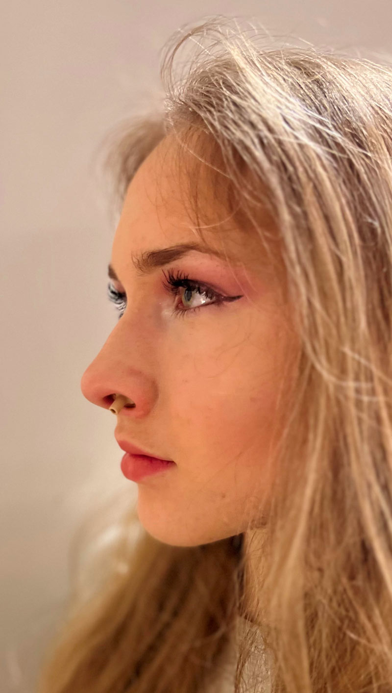 Hogne - Medical Device Innovations for ENT