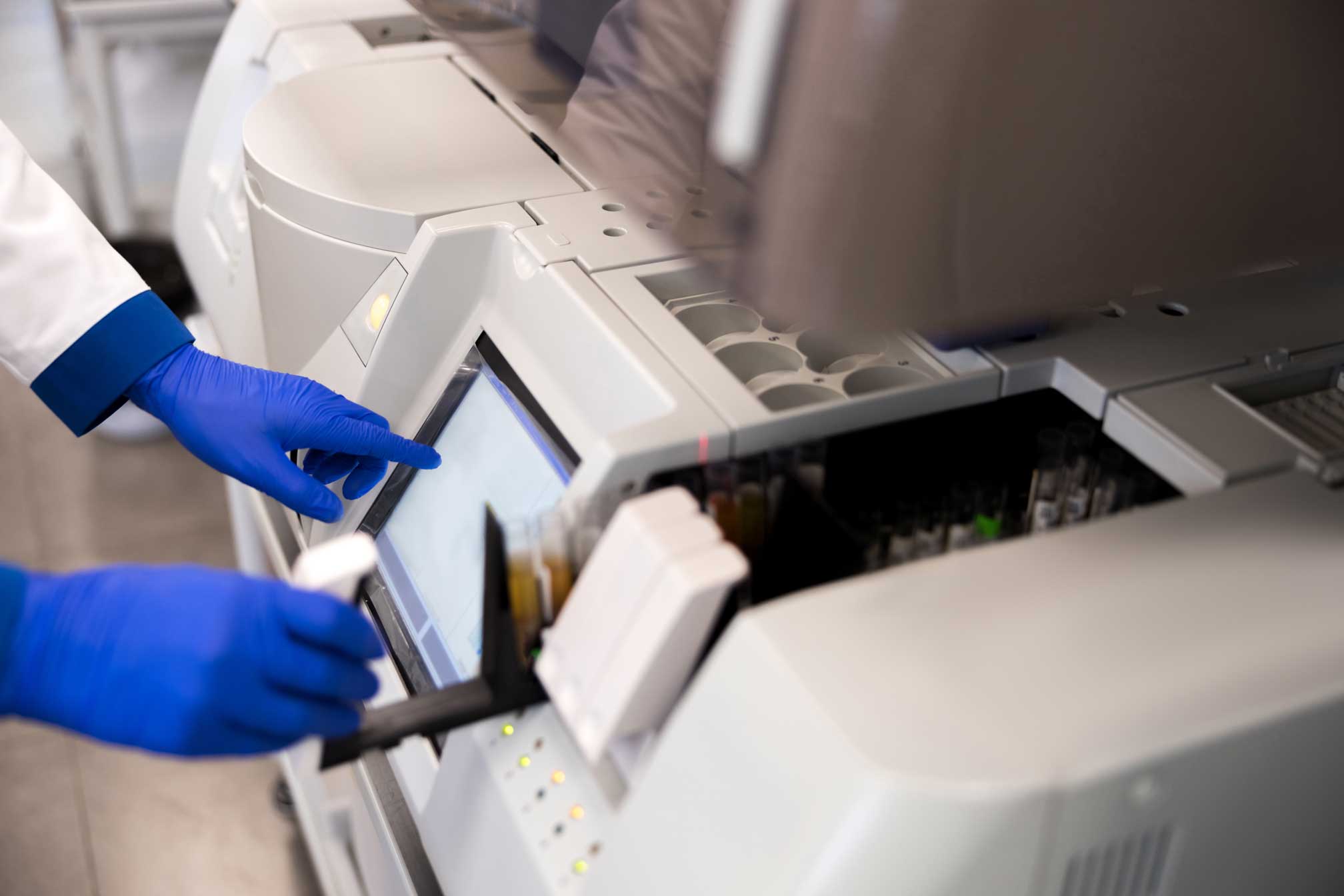 Product categories - ScheBo Biotech AG