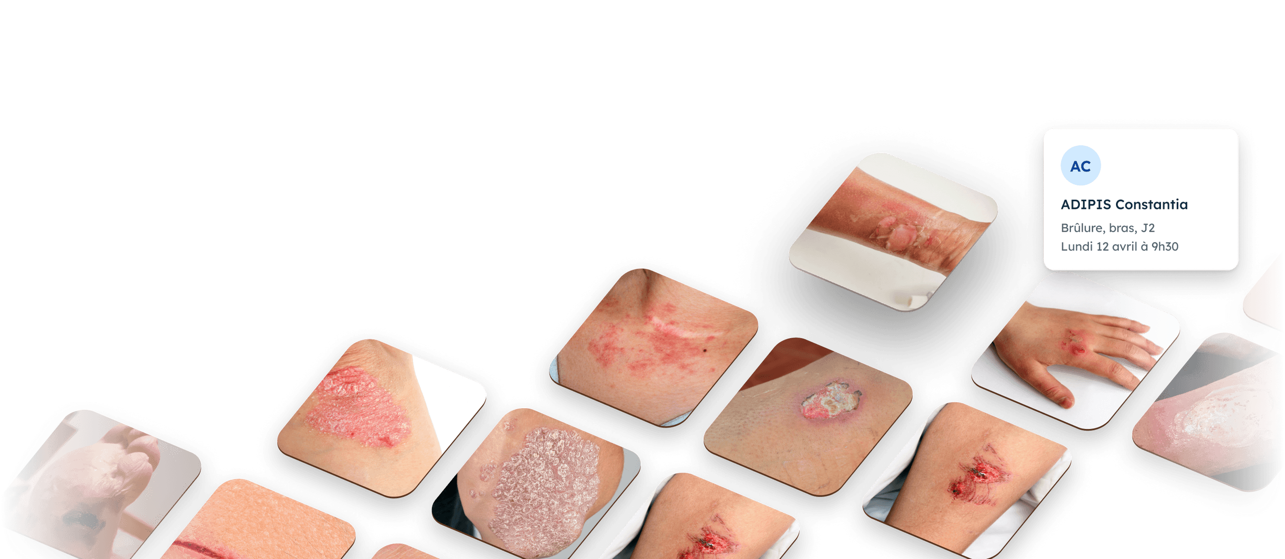 Gestion des photos médicales et suivi des plaies | Pixacare