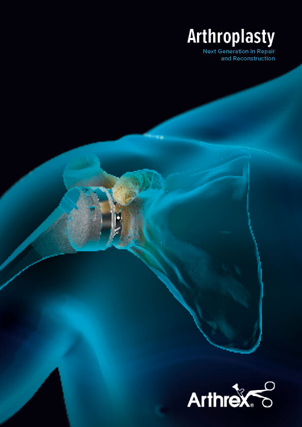 Your Specialist for Medical Technology | Arthrex Belgium