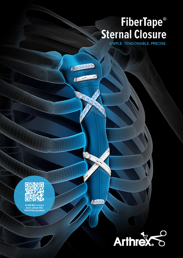 Your Specialist for Medical Technology | Arthrex Belgium