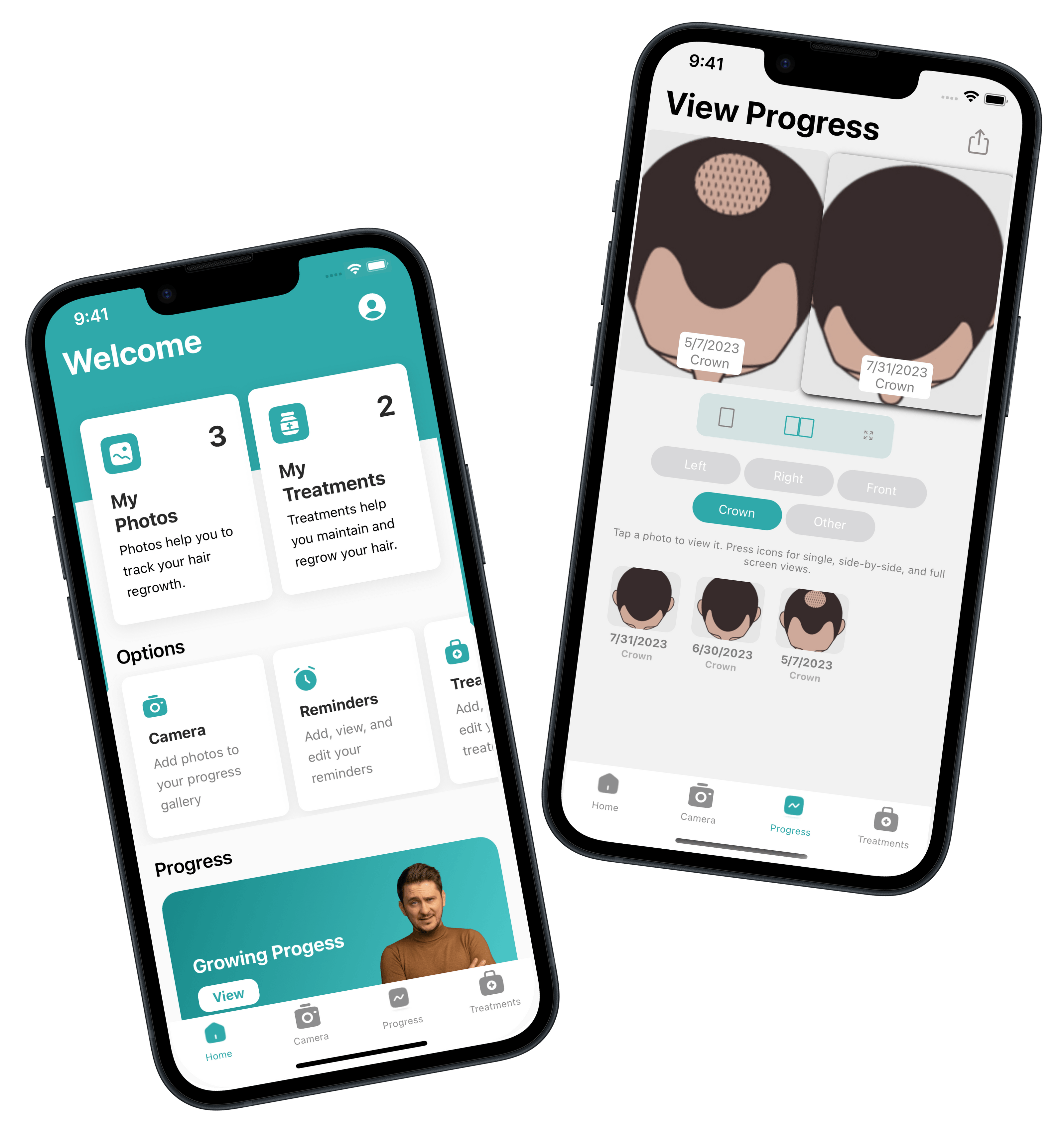 Hairly - Your Hair Regrowth Assistant | Install for Free
