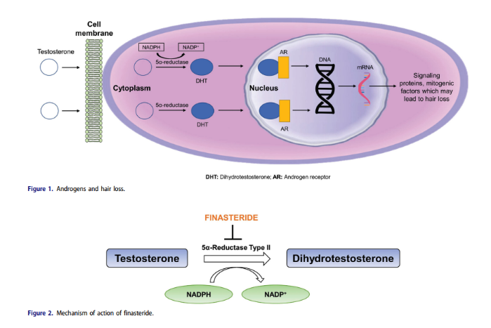 Topical Finasteride vs Oral Finasteride - Hairly