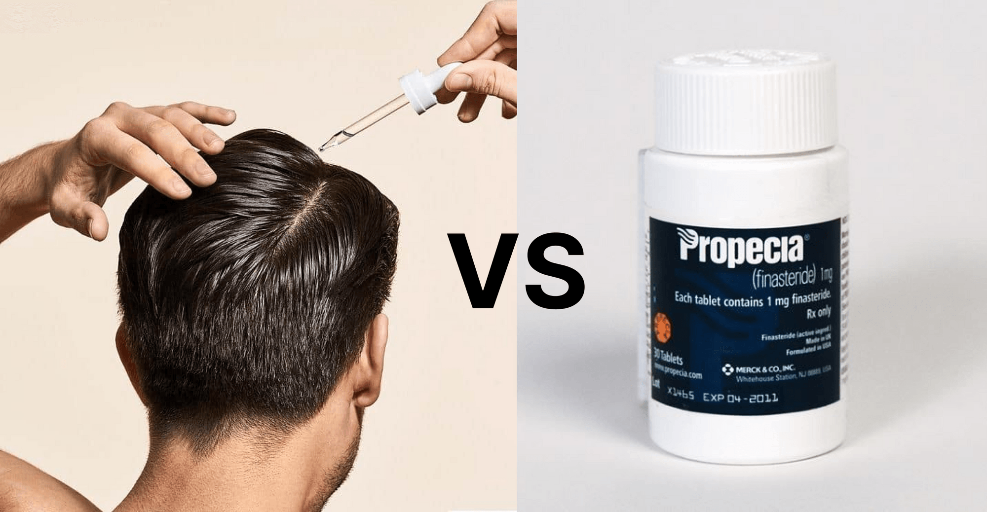 Topical Finasteride vs Oral Finasteride - Hairly