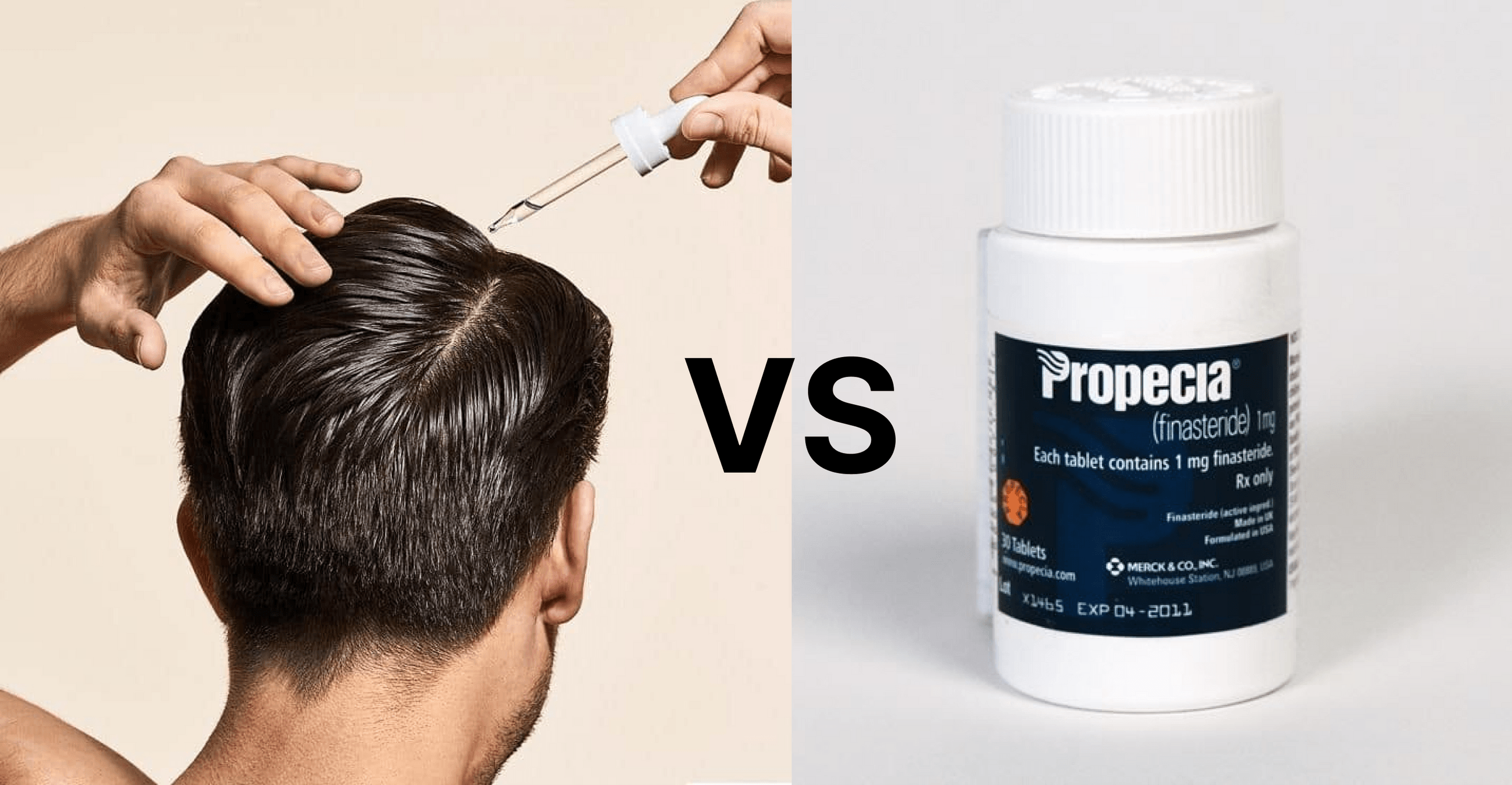 Topical Finasteride vs Oral Finasteride - Hairly