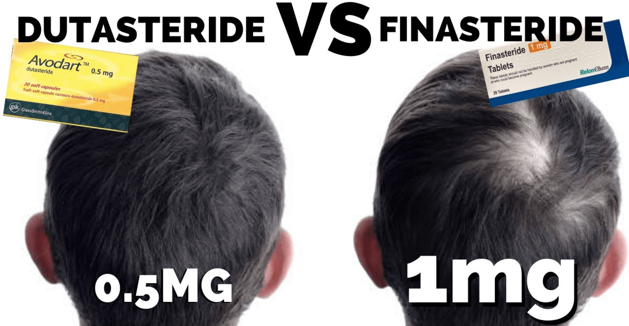 Finasteride vs Dutasteride: Everything You Need to Know - Hairly