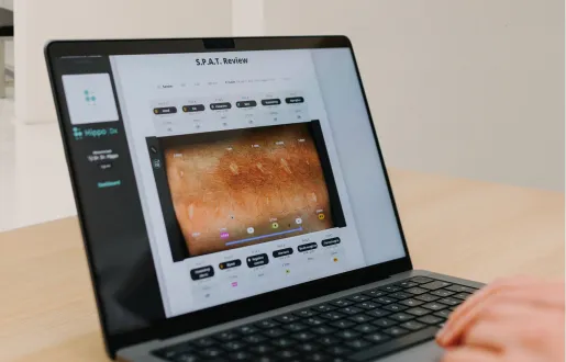 Allergy testing & diagnosis with automated skin prick tests.