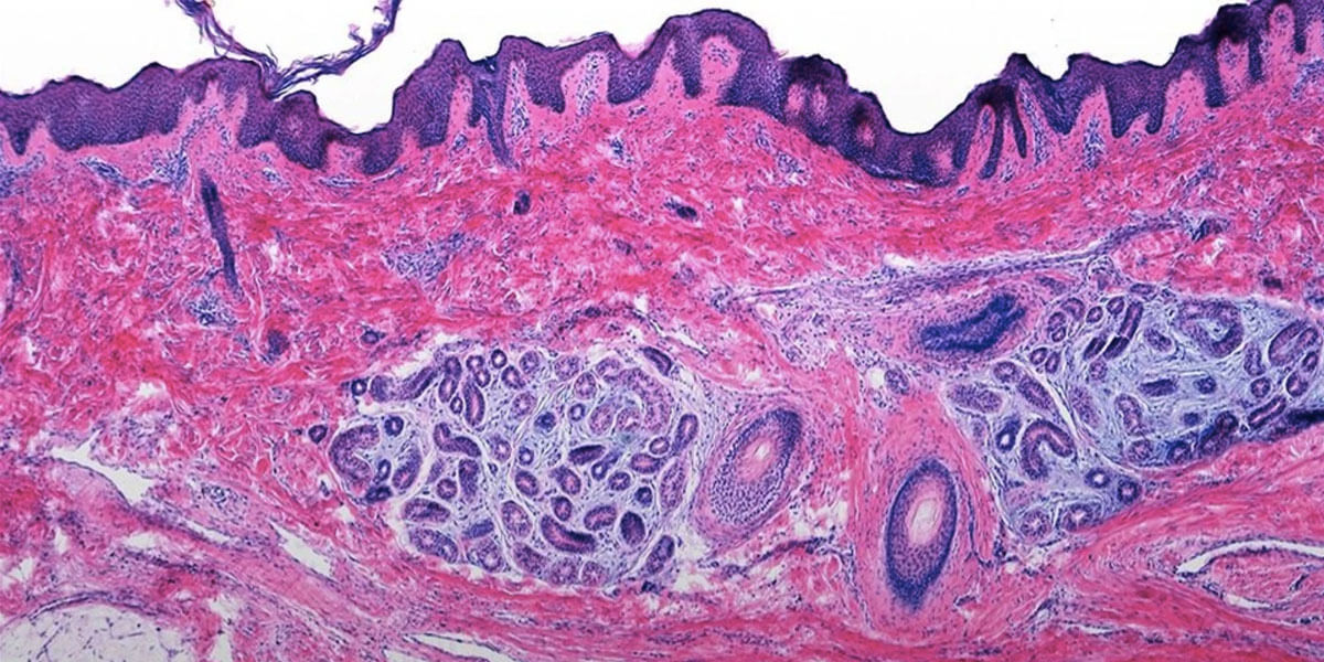 Vitro Molecular Laboratories