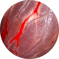 Arthrex Endoskopie und Synergy 4K | Arthrex Endoscopy
