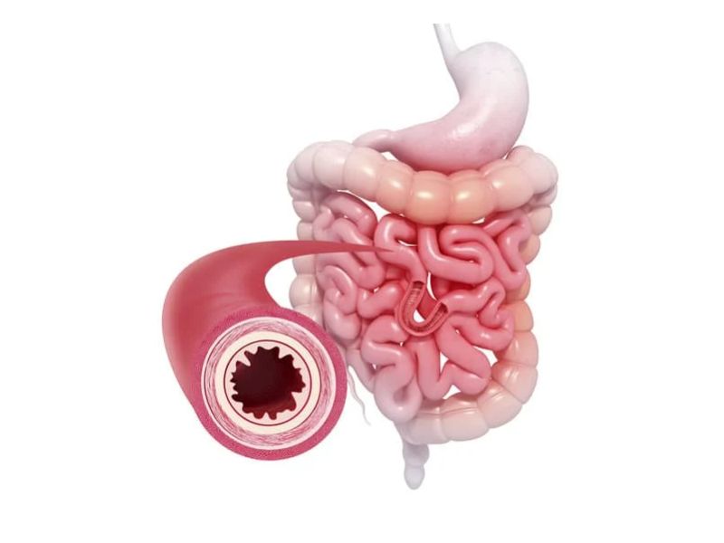 P499 Exclusive enteral nutrition induces transmural healing in adults ...