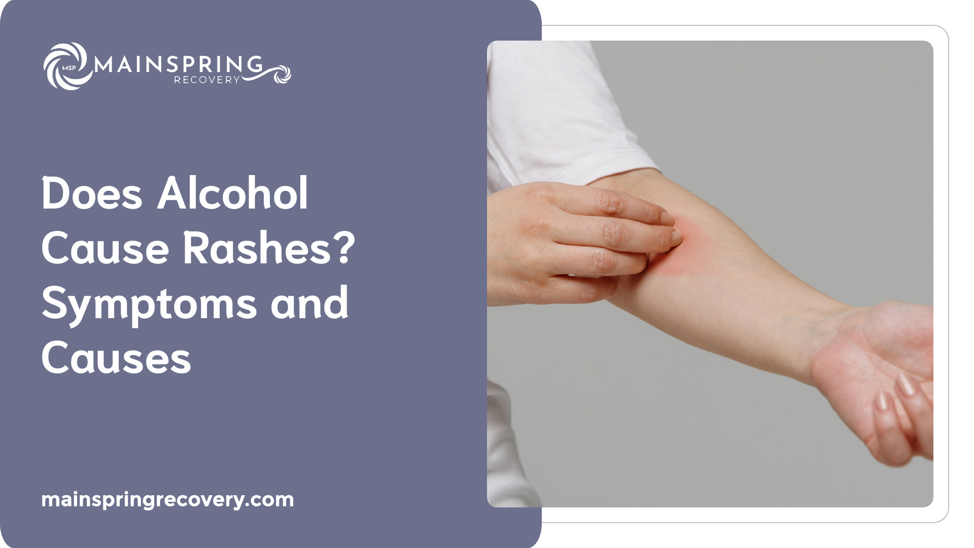 Does Alcohol Cause Rashes? Symptoms and Causes