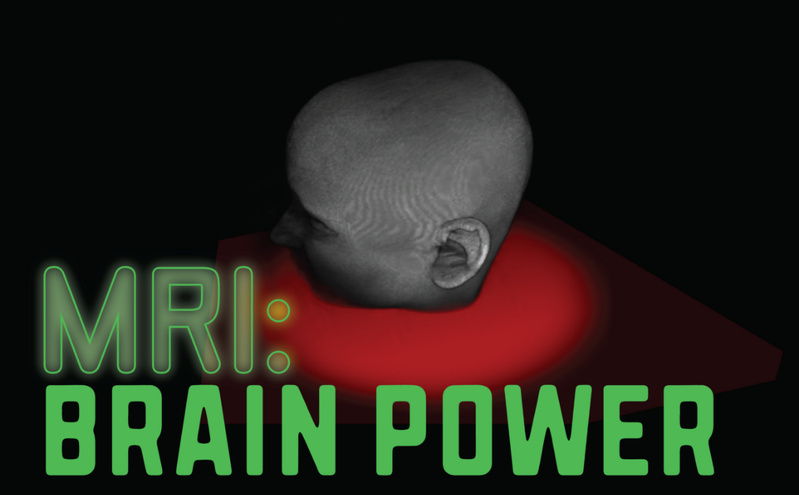 MRI: Brain Power | Tilt Five