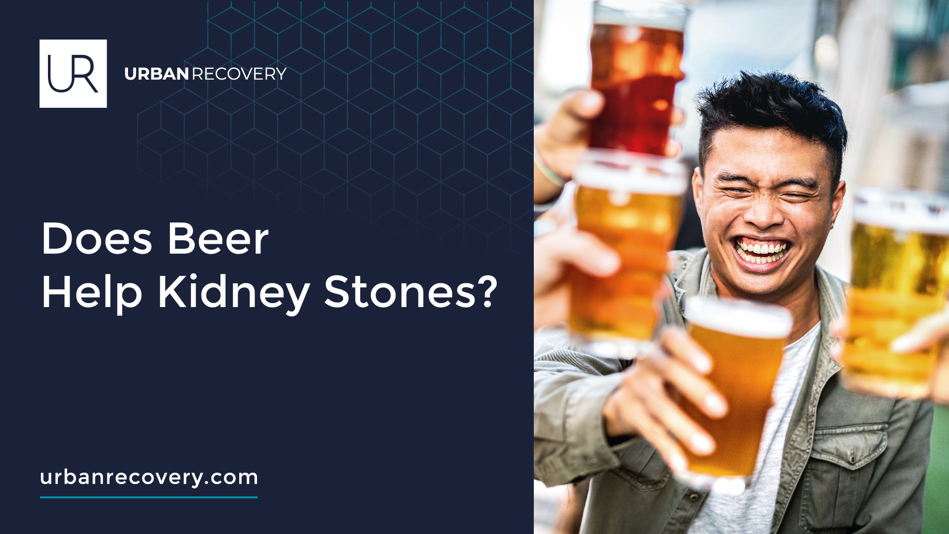 Does Beer Help Kidney Stones?