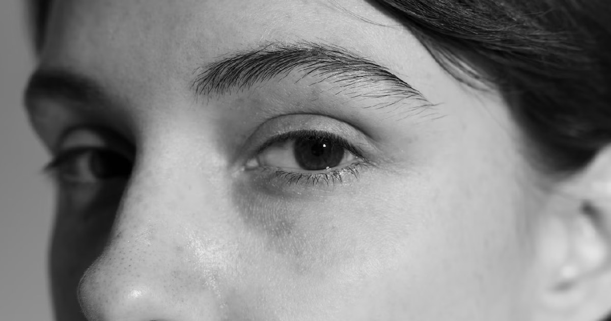 Fetal Alcohol Syndrome in Adulthood