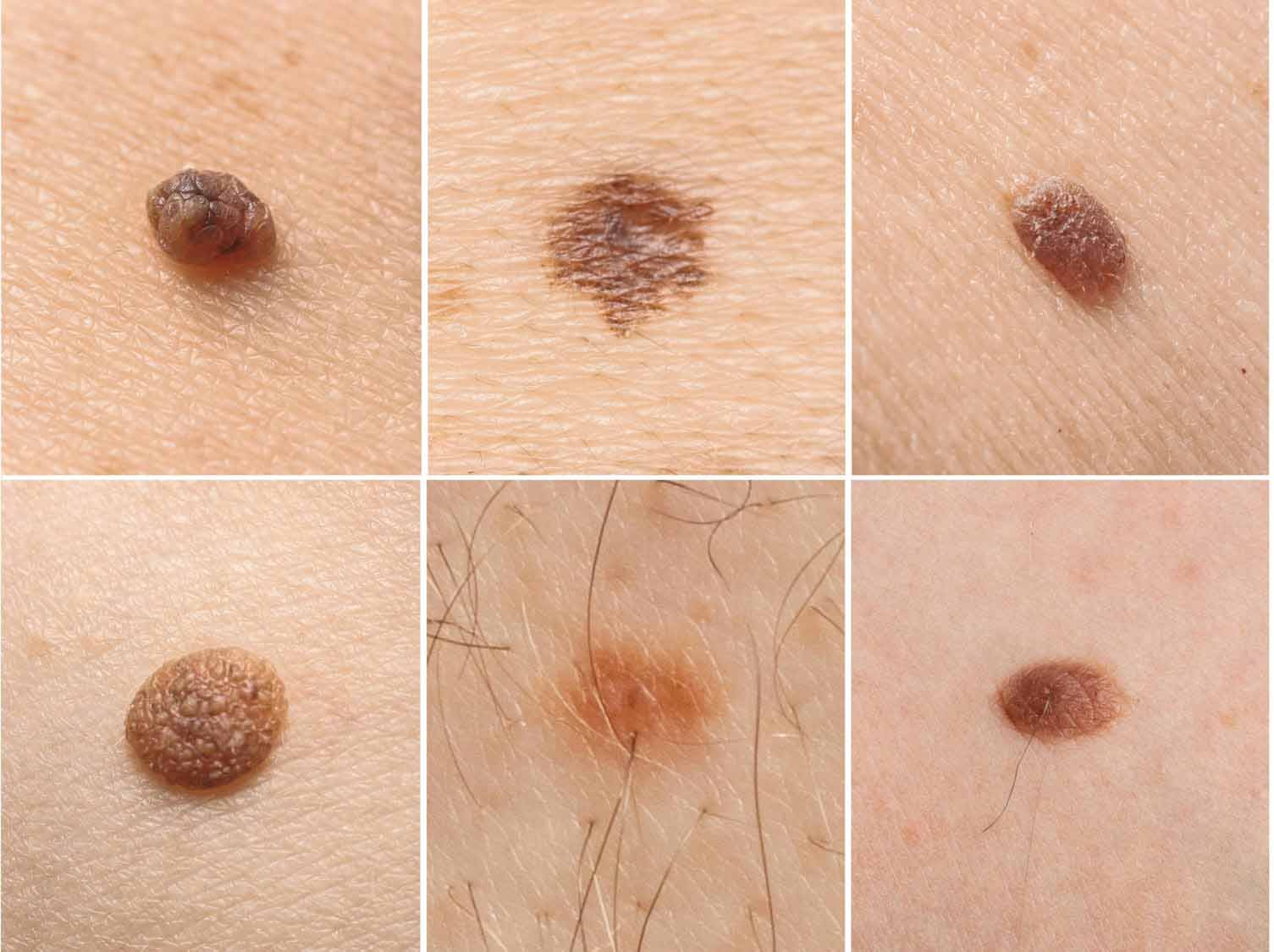 Skin Health Checks with Tend